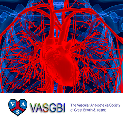 NAP7 - Perioperative Cardiac Arrest - VASGBI